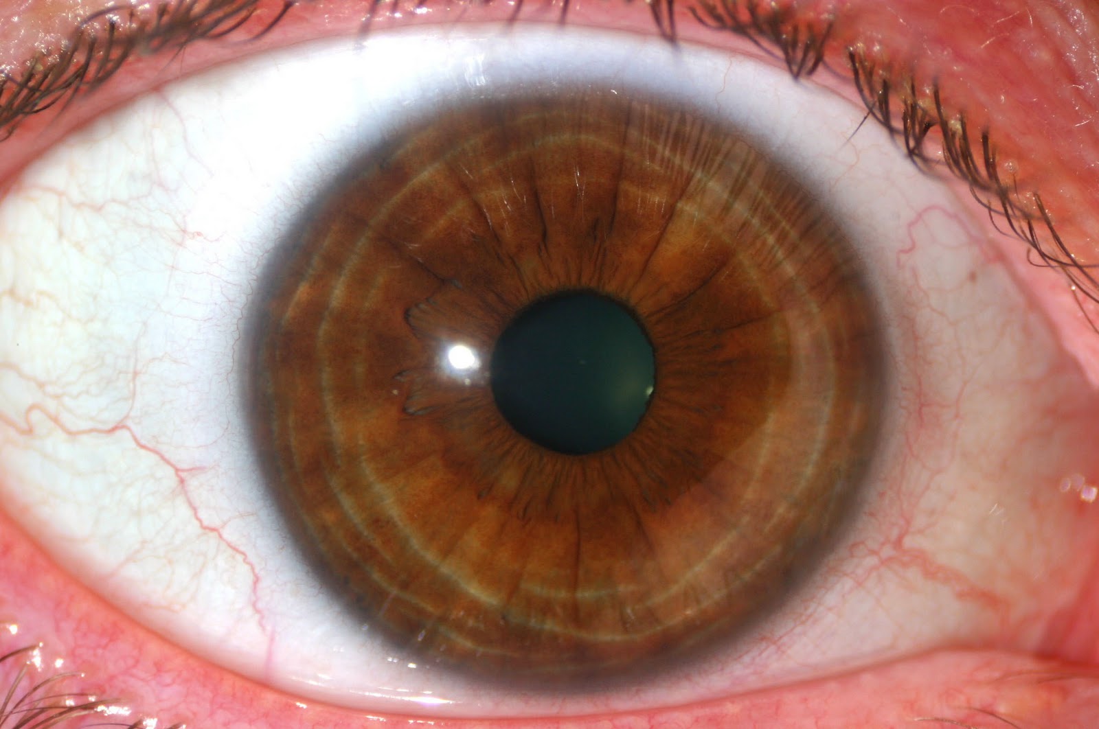 Eye Colors: Medium Brown Iris