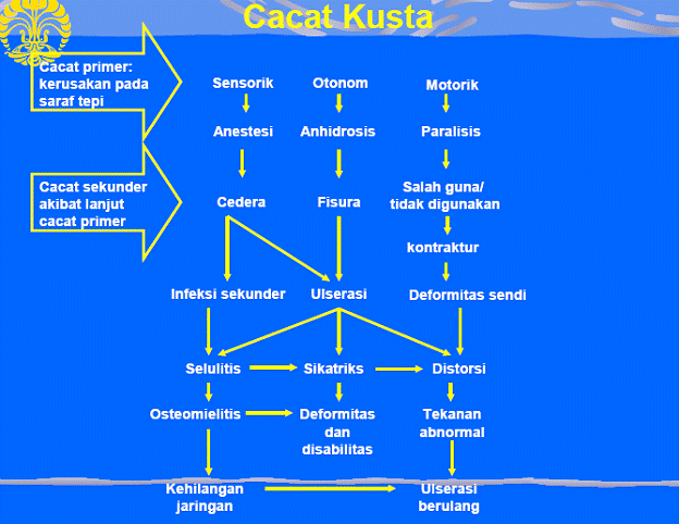 catatan-catatan kecil,.....: Morbus Hansen,...