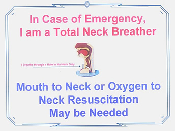 My Voice: Urgent care, CPR and care of laryngectomees during anesthesia ...