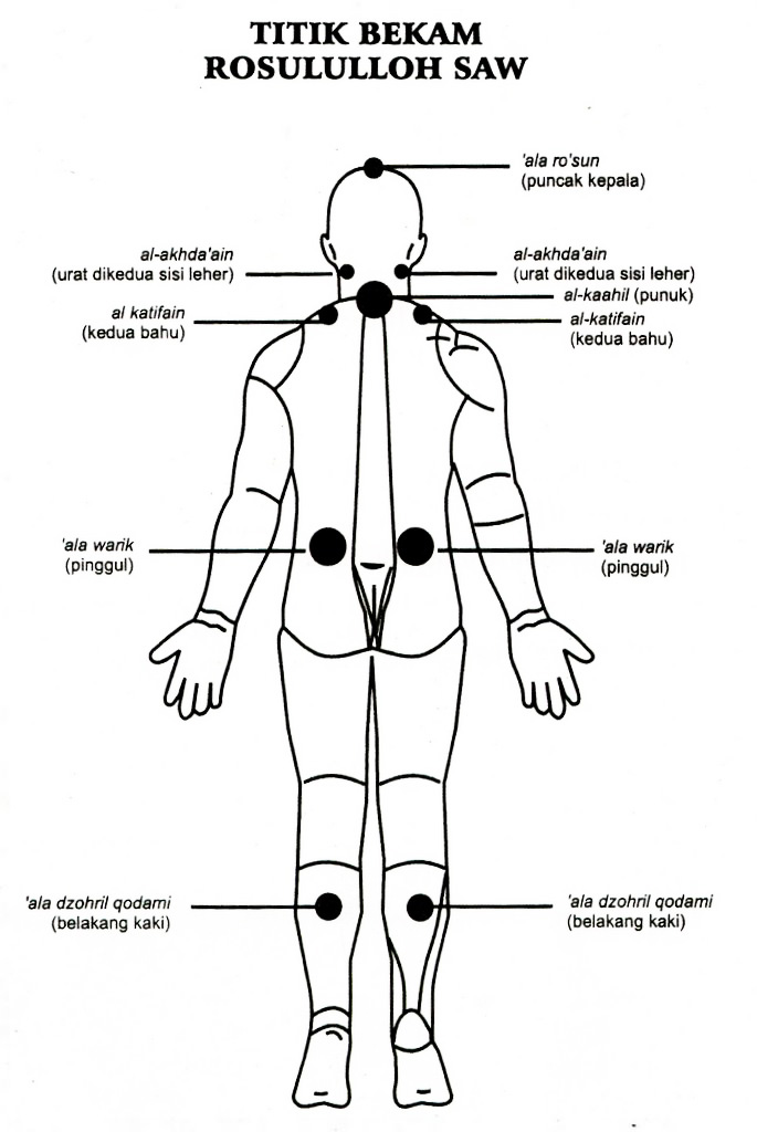 SPA SANTAI: Titik bekam dan Bekam Basah
