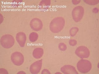 hematologia