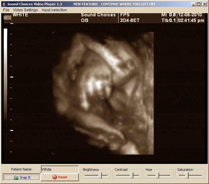 Counting Our Blessings: Jaxon's 4D Ultrasound @ 31 Weeks