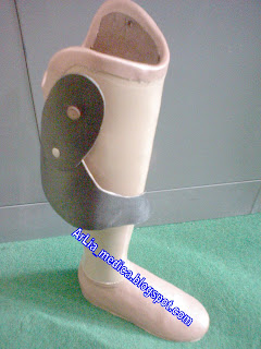 Patella Tendon Bearing (PTB) Prostesis | ArLia Medica