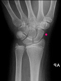 From the Mind of a (Newly Graduated) Chiropractic Student: Radiology #1 ...