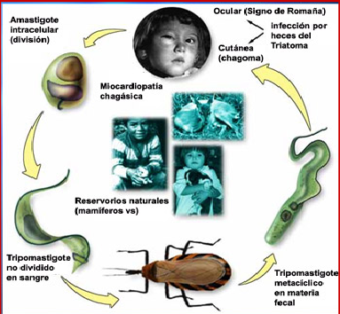 Chagas: ENFERMEDAD DE CHAGAS
