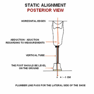 osteo support: TRANS-TIBIAL STATIC ALIGNMENT