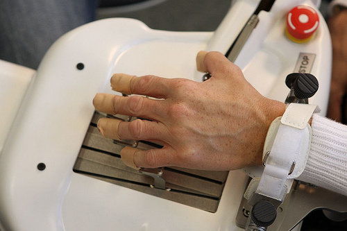 REHABILITACIÓN Y MEDICINA FÍSICA. Mirando al futuro.: TYROMOTION ...