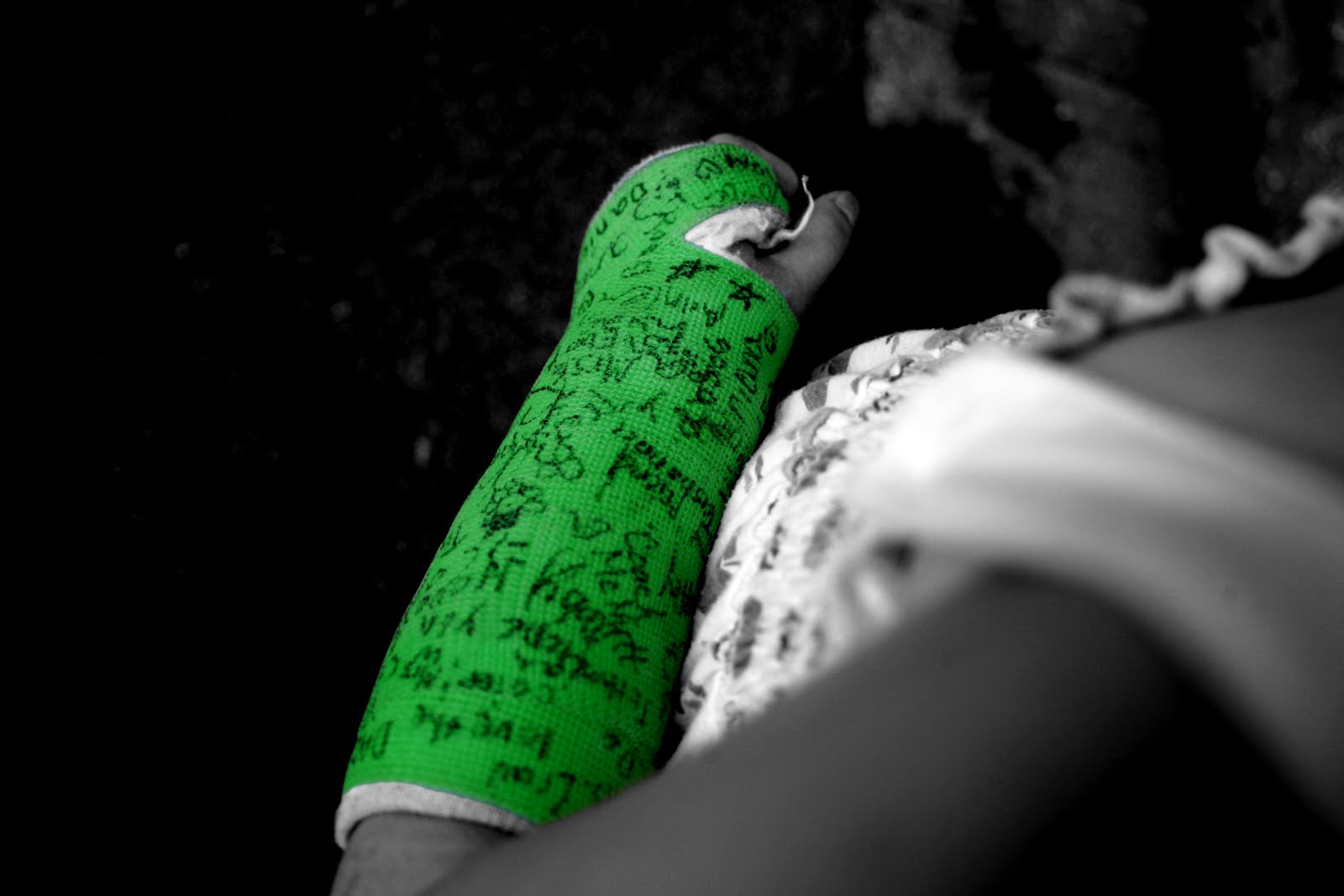 My collection of pictures: Buckle Fracture