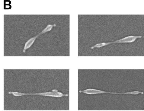 Life of a Lab Rat: Bacteria that tear themselves apart