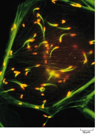 Life of a Lab Rat: Bacterial comet tails