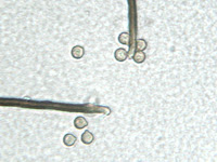 MICOLOGIA PANAMENSIS: NOTAS MICOLOGICAS(95).OBSERVACIONES SOBRE EL ...