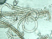 MICOLOGIA PANAMENSIS: NOTAS MICOLOGICAS (13). OBSERVACIONES SOBRE EL ...