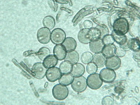 MICOLOGIA PANAMENSIS: NOTAS MICOLOGICAS(47) OBSERVACIONES SOBRE EL ...