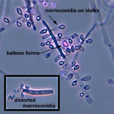 Medical Microbiology: Suspected Fungi