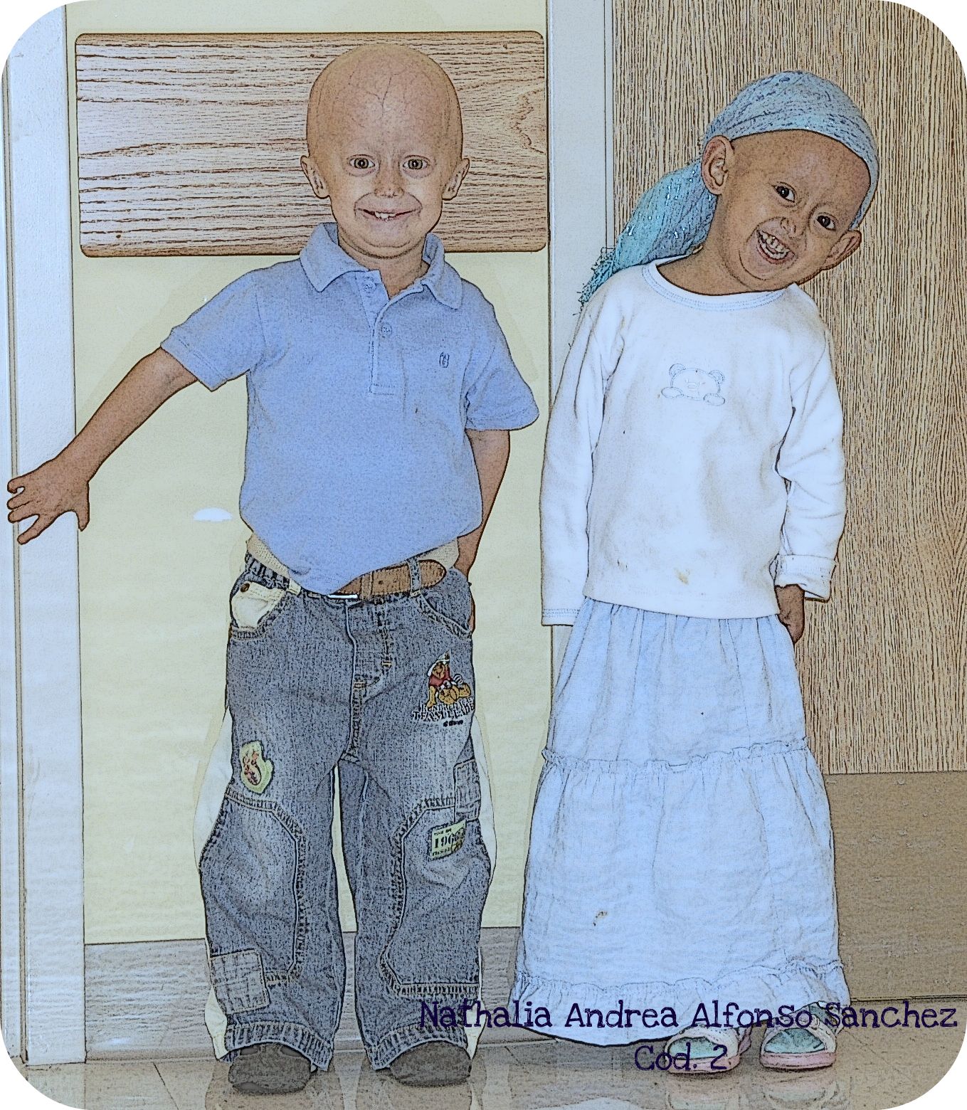 Nathalia Alfonso: Progeria