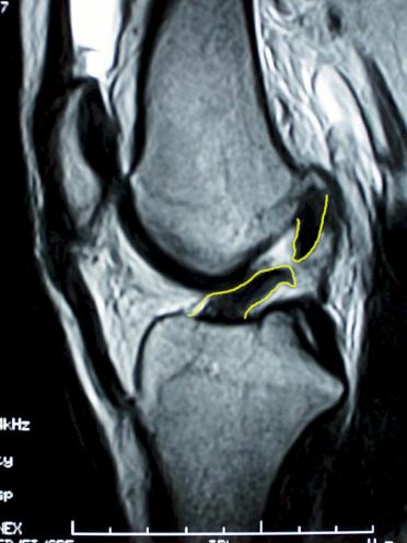 Procedures- Pathology Blog