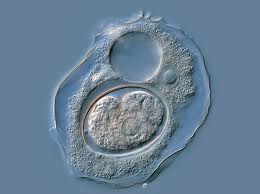 Un perro naranja: Biografía de una ameba