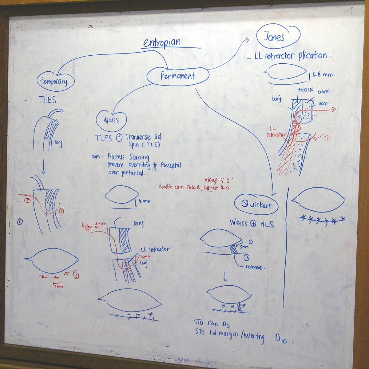 UKM Ophthal Part 2 2010: Entropion
