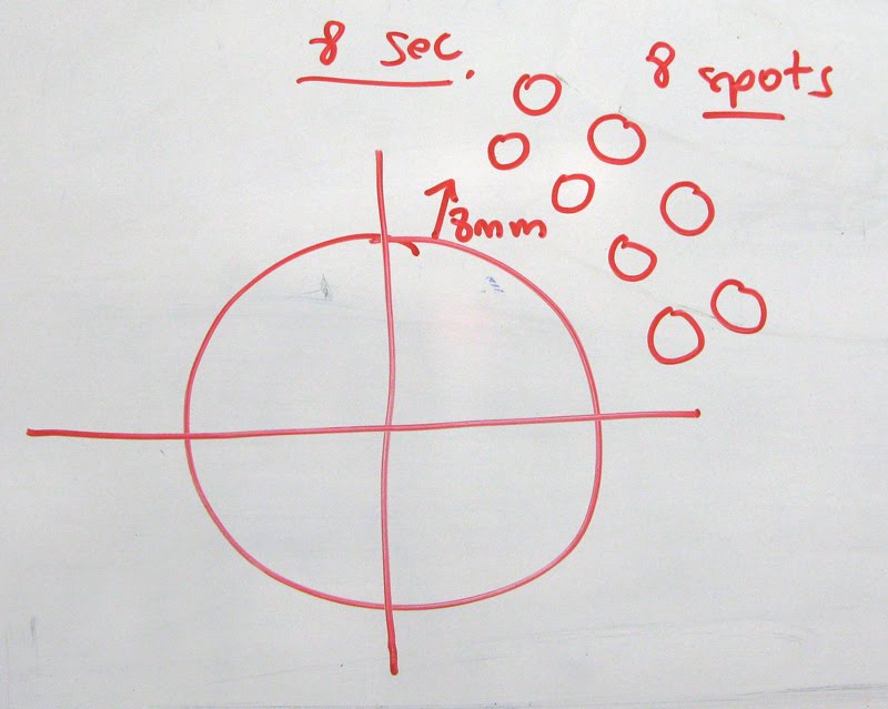 UKM Ophthal Part 2 2010: ARC's rule of 8