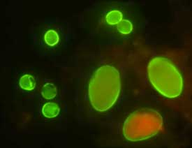 Epidemiologia Escobar: Giardiasis - Giardia Lamblia - Epidemiologiaescobar