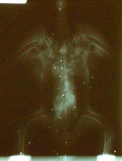 World Bird Sanctuary: Lead Poisoning