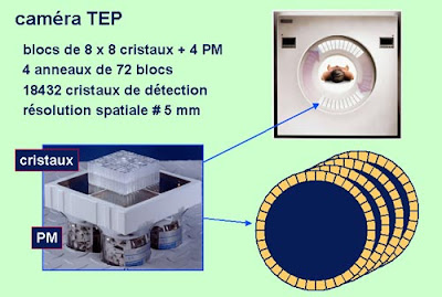 LA RADIOACTIVITE DANS LA MEDECINE.: 3. TEP (Tomographie par Emission de ...