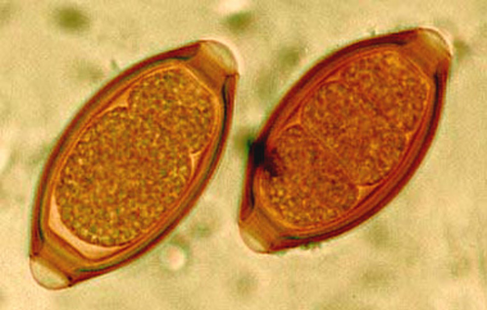 parasitic gastrointestinal infection....: Diagnosis