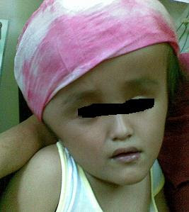 A CASE OF MACROCEPHALY