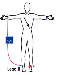 Basic ECG | Biomedical Engineering Elektromedik
