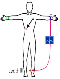 Basic ECG | Biomedical Engineering Elektromedik