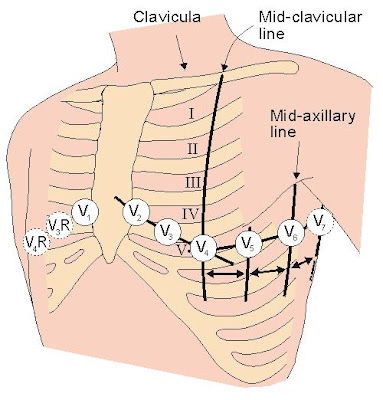 Basic ECG - BangBel