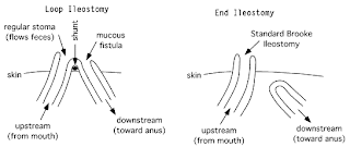 CRAPBAG AND THE PRINCESS: FAQs