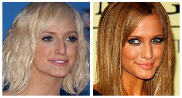 Plastic Surgery Before And After: Ashlee Simpson Nose Job