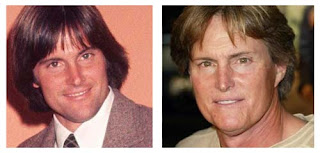 Plastic Surgery Before After: Bruce Jenner Plastic Surgery