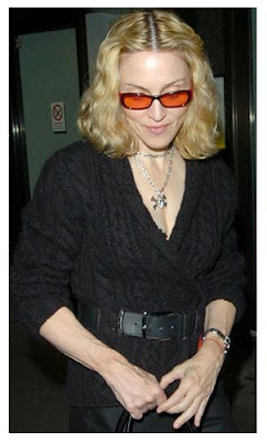 Plastic Surgery Before And After: Madonna Plastic Surgery