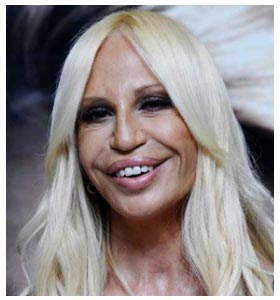 Plastic Surgery Before And After: Bad Rhinoplasty