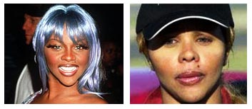 Plastic Surgery Before And After: Lil Kim Before And After Surgery