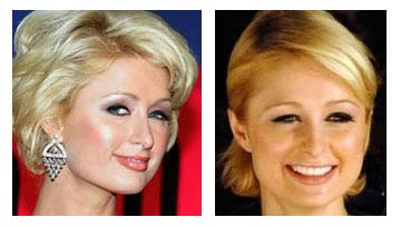 Plastic Surgery Before And After: Paris Hilton Plastic Surgery
