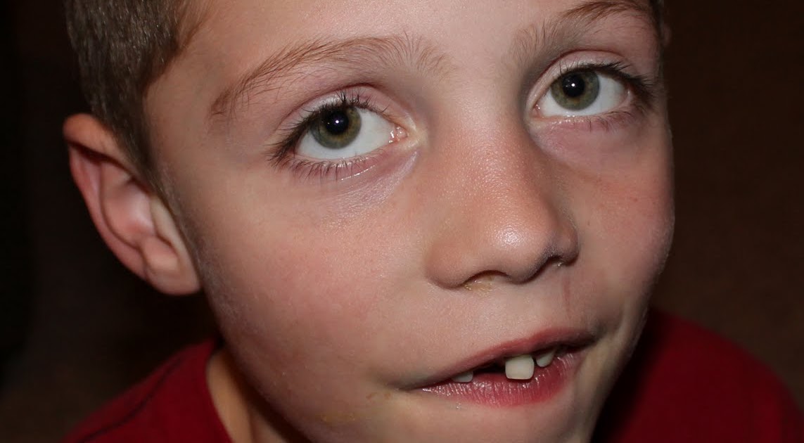 Kar's Kith and Kin: No More Snaggle Tooth