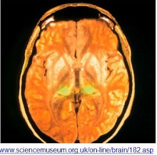 STAY TUNE TO V.R.S: SPONGE-LIKE Human Brain!!!
