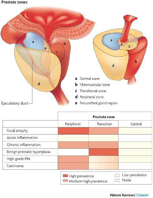 Urología Peru Dr. Susaníbar.