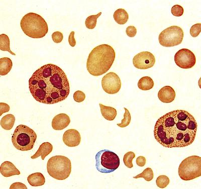 Fonte: Métodos de Laboratório Aplicados à Clínica, J. Cançado.