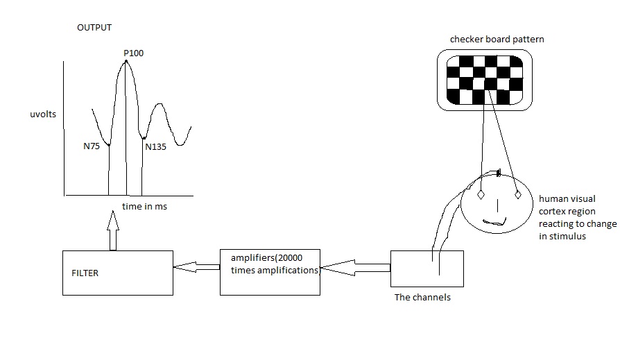 svep testing for amblyopia detection in infants: Block diagram of the ...