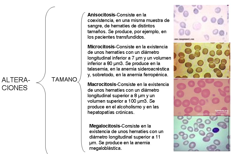 BIOMETRIA HEMATICA: ALTERACIONES DE LOS HEMATIES