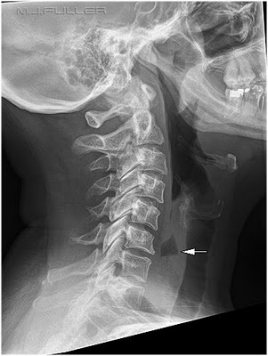 My two cents: I hate fish..