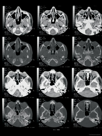 Biomedical Engineering