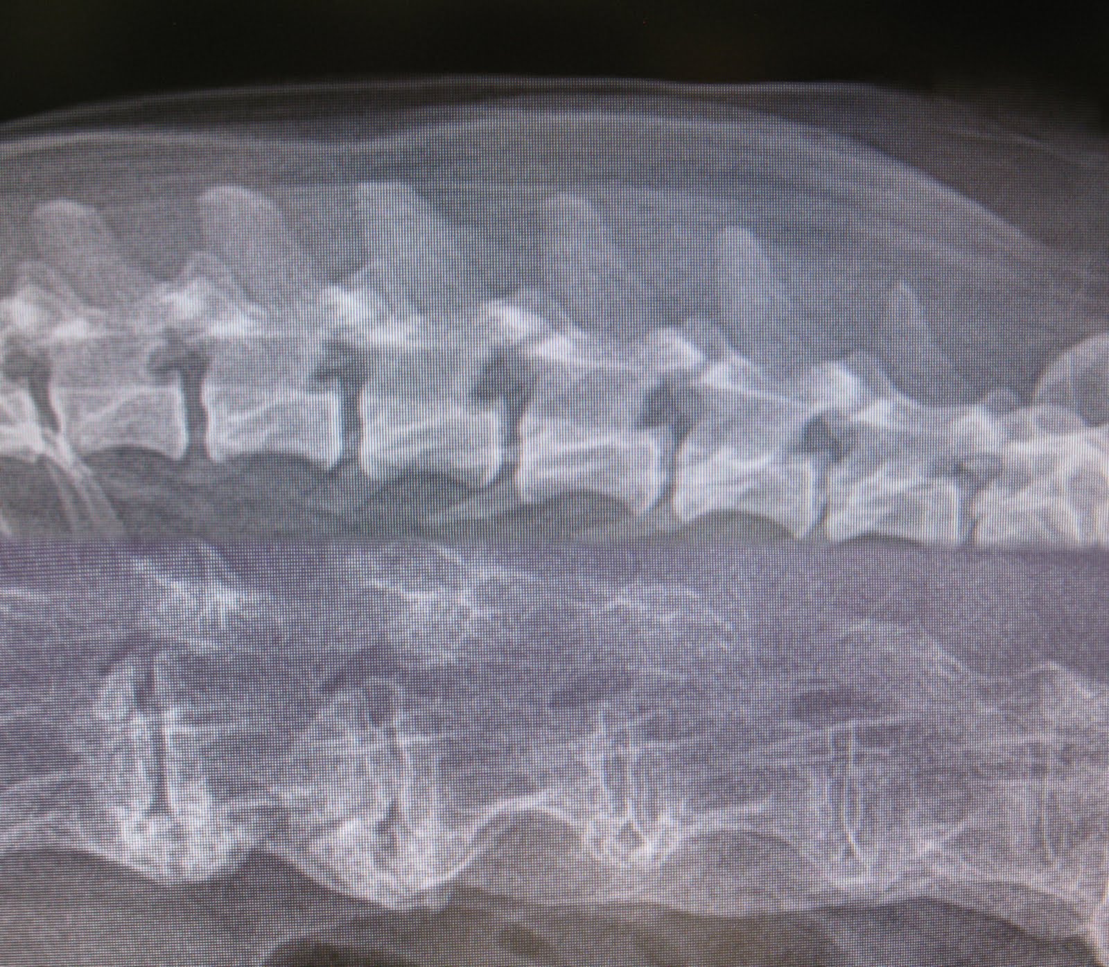 Days at Foothills Animal Hospital: Spinal Fusion