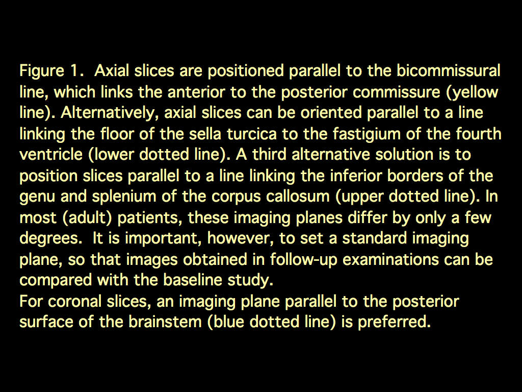 MRI BLOG: Brain MRI (Imaging Planes)