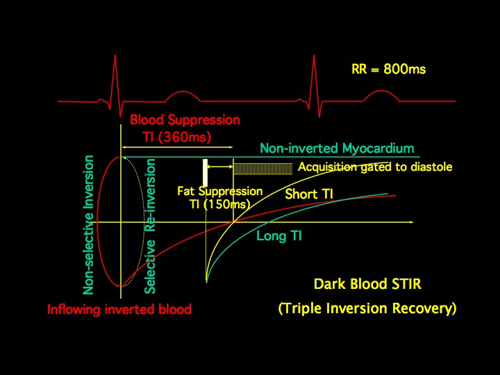 Pulse Sequence Diagram Mri