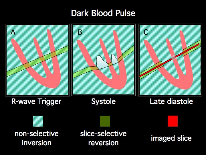MRI BLOG: Pulse Sequences for Cardiac MRI
